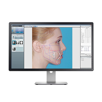 OrthoVision - 2D Software - VATECH