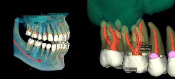 Vatech Enhances AI in Dental Diagnostic Solutions - News - VATECH